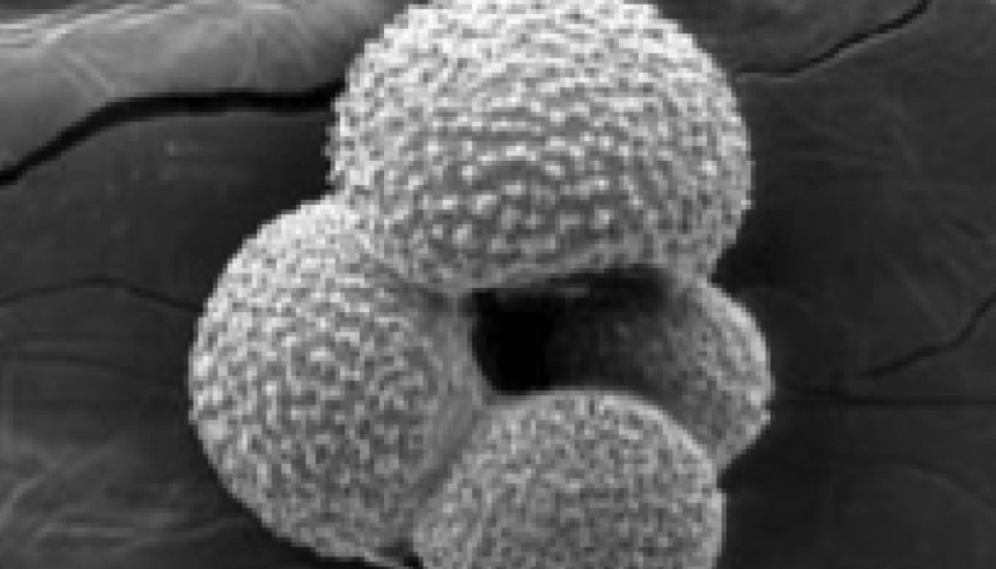 Climate Past Present Future Forams The Sea Thermometers Of The Past climate-past-present-future-forams-the-sea-thermometers-of-the-past